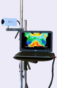 Products & Specifications- Spectron IR Medical Infrared Imaging