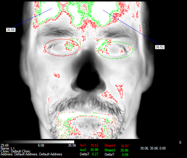 Products & Specifications- Spectron IR Medical Infrared Imaging