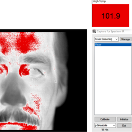 Spectron IR- Dedicated Medical Thermal Imaging Cameras