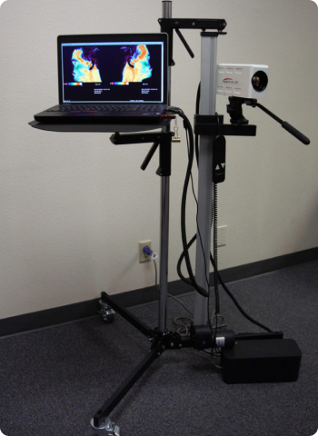 Products & Specifications- Spectron IR Medical Infrared Imaging